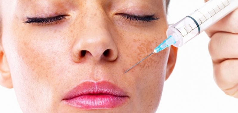 Clínica De Estética Up Preenchimento Acido Hialurônico Estetica Up